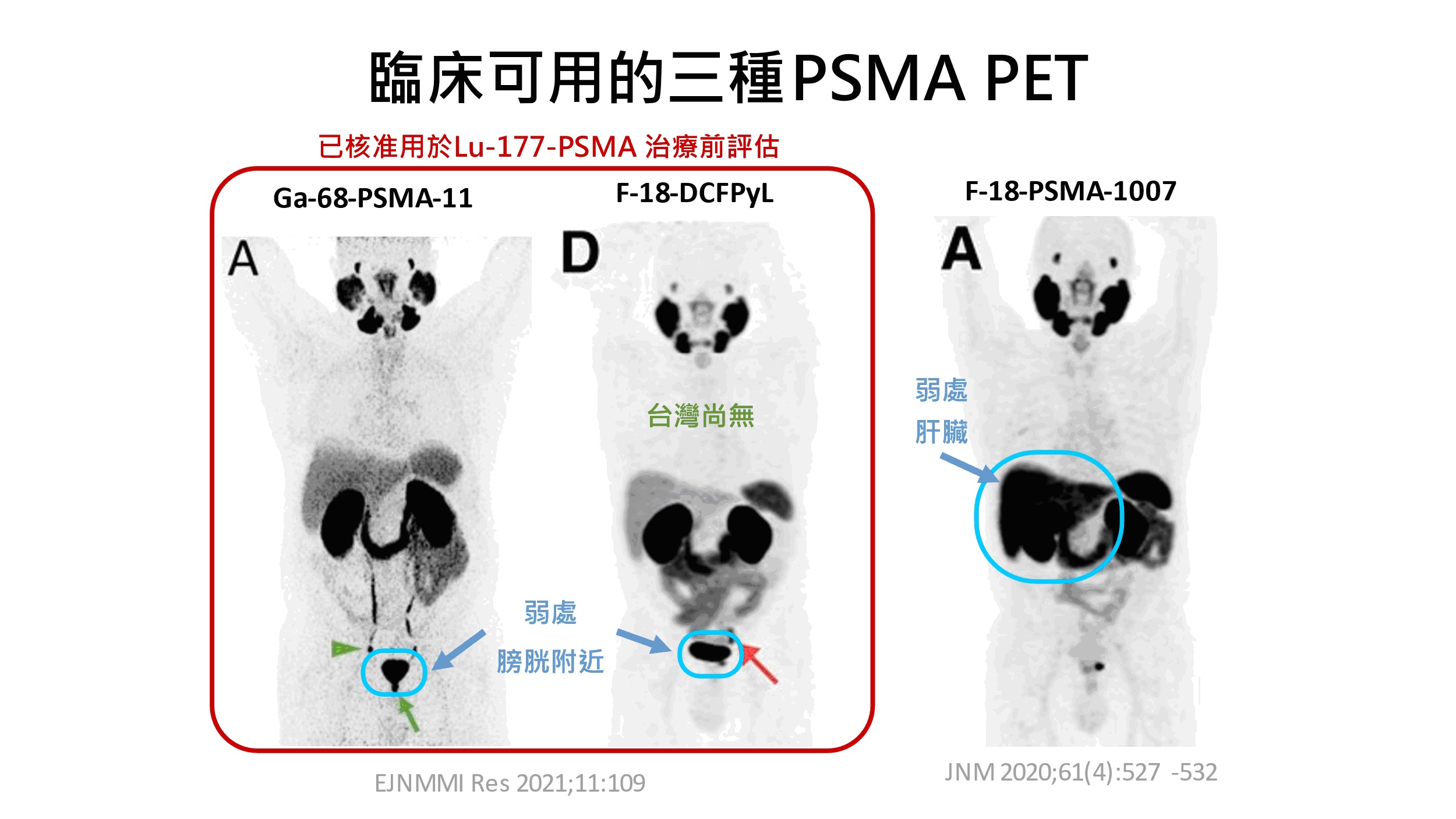【和信醫訊vol.38】PSMA 正子掃描幾多種? 有差別嗎? – 醫療財團法人辜公亮基金會和信治癌中心醫院